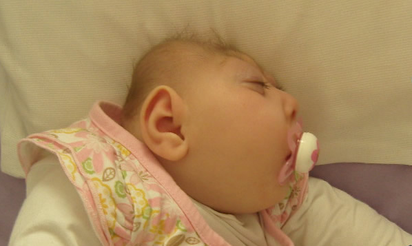 Raquel Roque: MICROCEFALIA