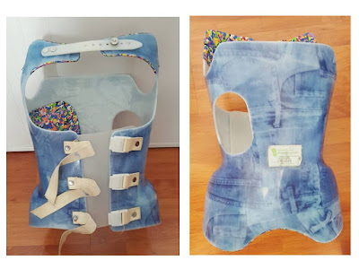 Despre corsetul Cheneau :: Corset scolioza / scoliosis braces