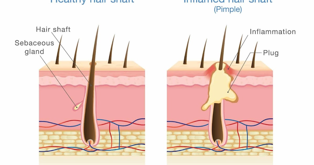 Scalp and Skin Blog: What Causes A Sensitive or Tender Scalp To Touch