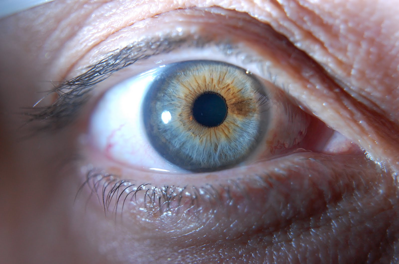 Iridología en valencia: Estudio de un iris desde la Psico-iridología