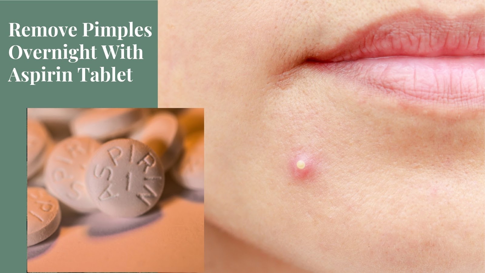 Remove Pimples Overnight With Aspirin Tablet ~ Makeup Vine Remove Pimples Overnight With Aspirin Tablet ~ Makeup Vine
