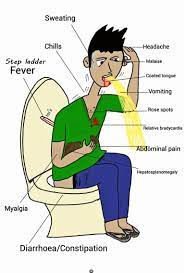 Typhoid: Pathogenesis, Clinical features and Complications.