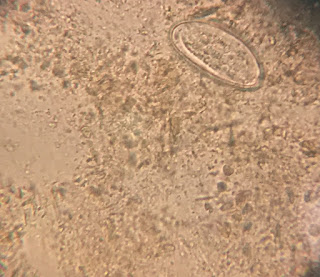 Z życia diagnosty laboratoryjnego: Owsiki