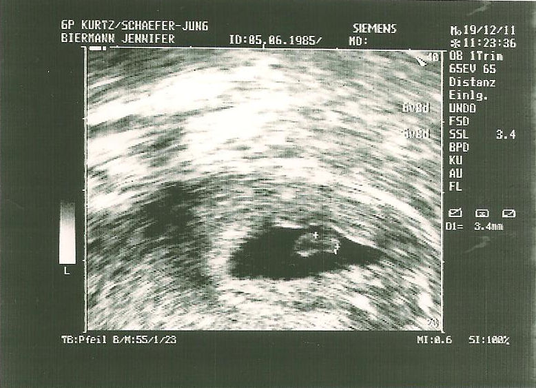 Operation: Baby #4: Ultrasound Pics