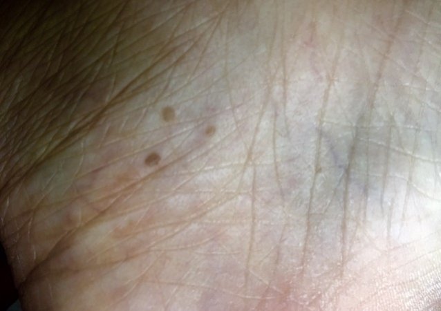 Skeptical Psychic: Triangular Marks and Aliens - Am I a Human Crop Circle?