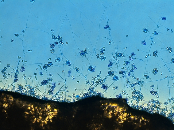 Fun With Microbiology (What's Buggin' You?): Trichothecium roseum