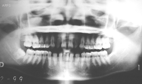 Embriología Bucodental: Biopatologías y consideraciones clínicas de la ...