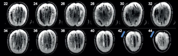 The Neurocritic: tDCS Symposium Stimulates Giant Brain in Chicago