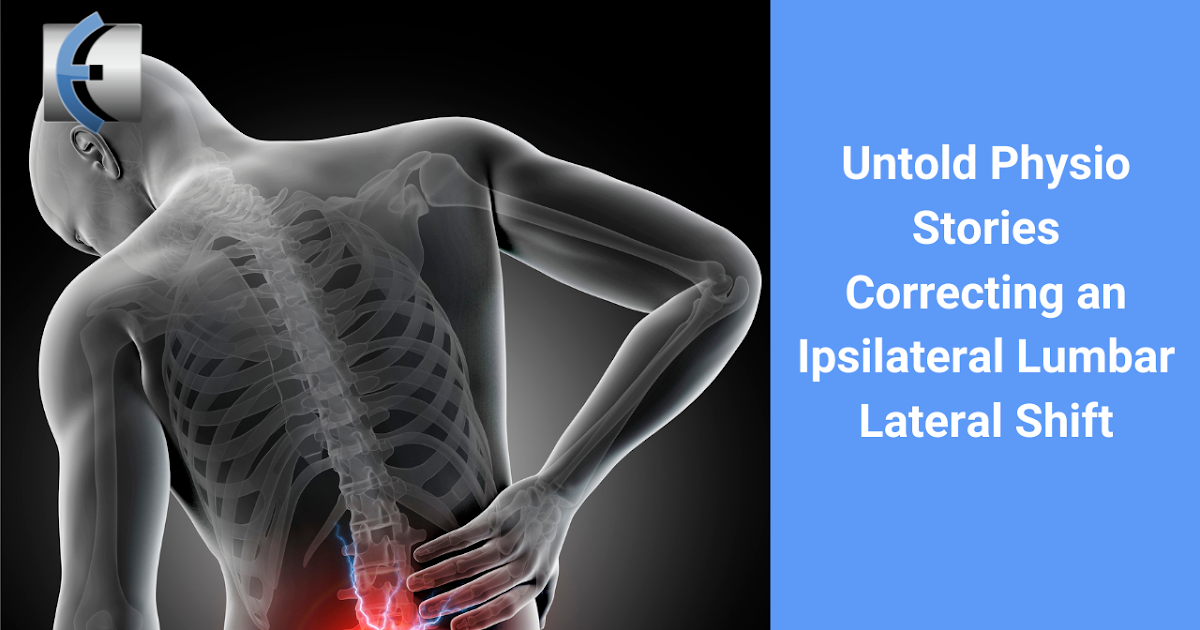 Untold Physio Stories - Correcting an Ipsilateral Lumbar Lateral Shift ...