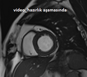 TÜM AŞAMALARI İLE KARDİAK MR TEKNİĞİ_1_KALBİN POZİSYONLARINI ELDE ETME