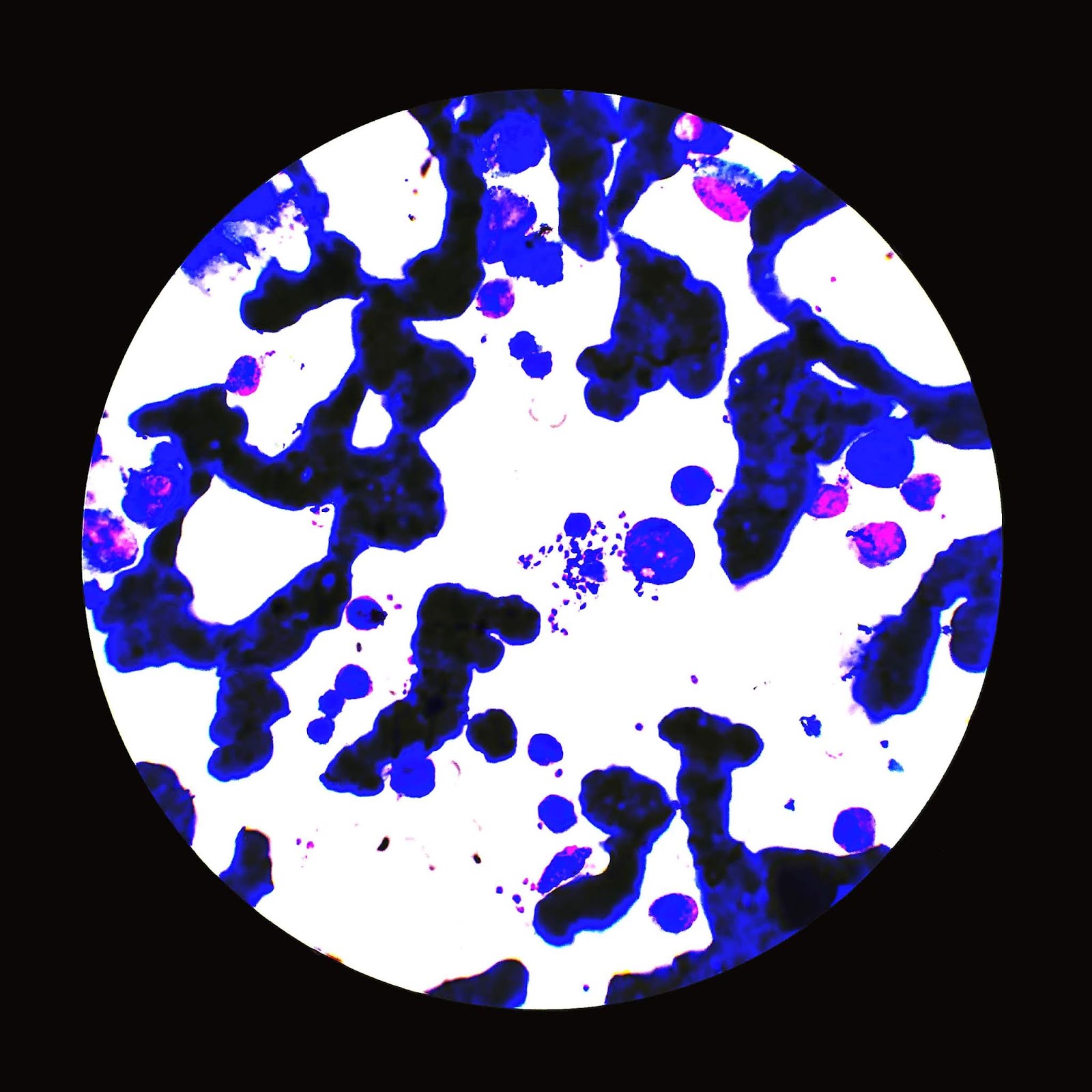 MICROBIOLOGY BLOG FOR STUDENTS (MBLOGSTU): Leishmania donovani bodies ...