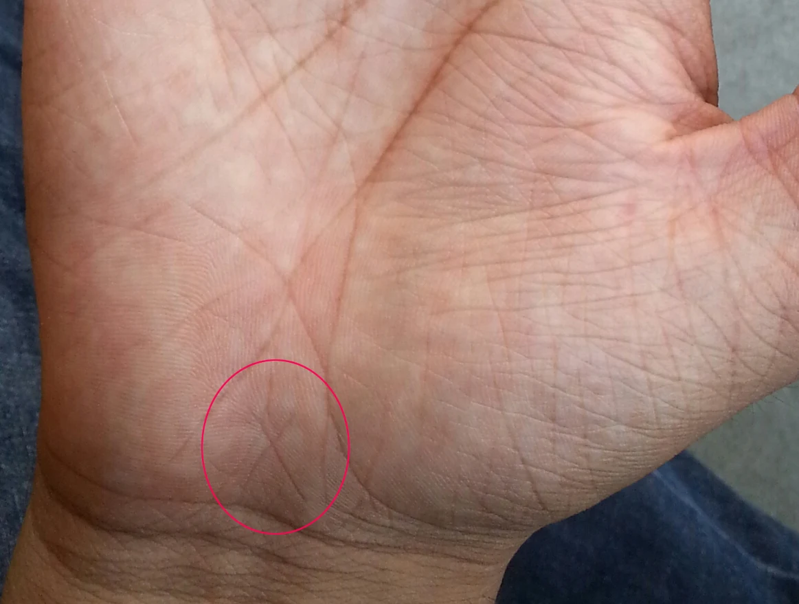 Cross Above Bracelet Line Practical Palm Reading ~ INDIAN PALMISTRY ...