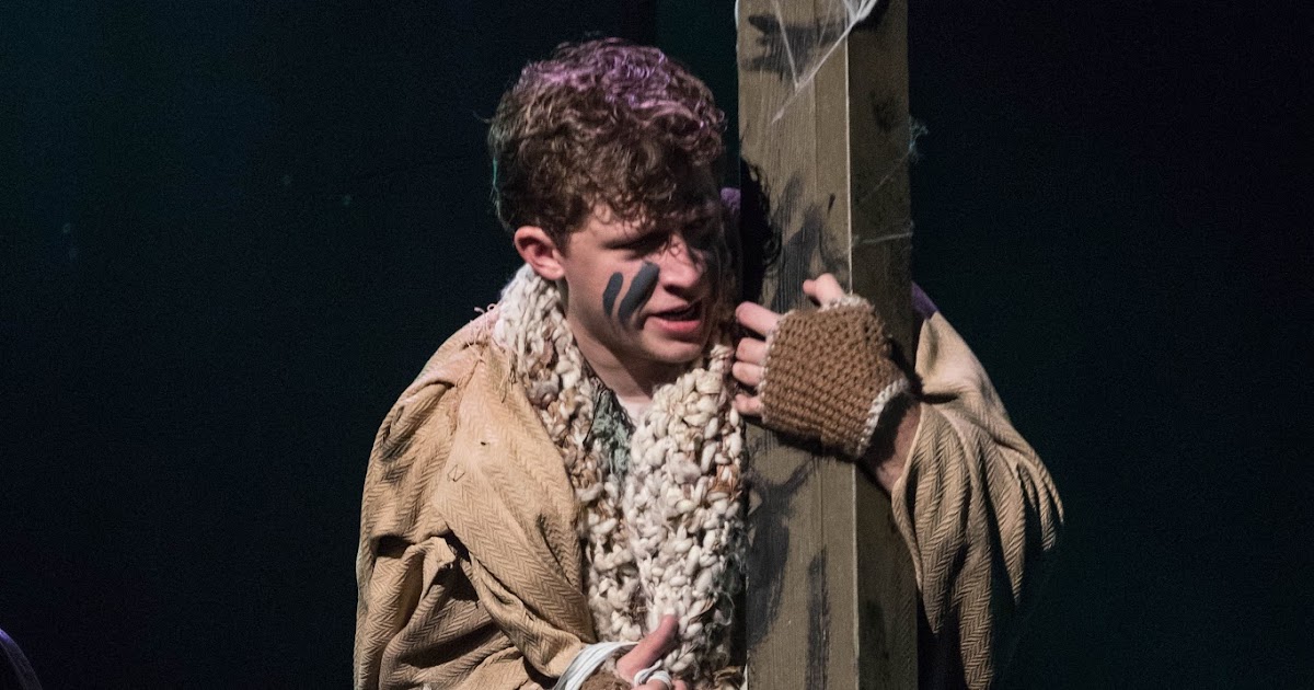 Collection Of Real Hunchback People Impact Performance