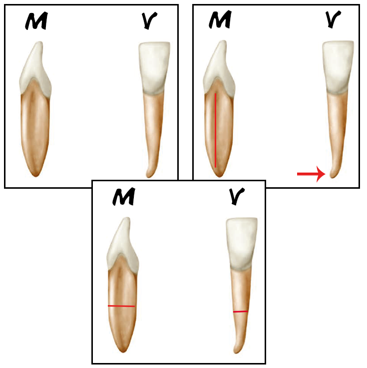 Aula de Anatomia Dental - Incisivo Central Inferior - Dente 31 e 41 ...