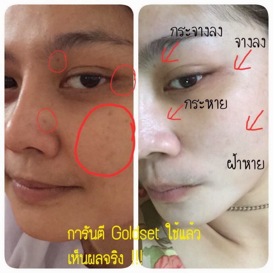 Freshy Face Gold Set Thailand: What is Freshy Face Gold Set?