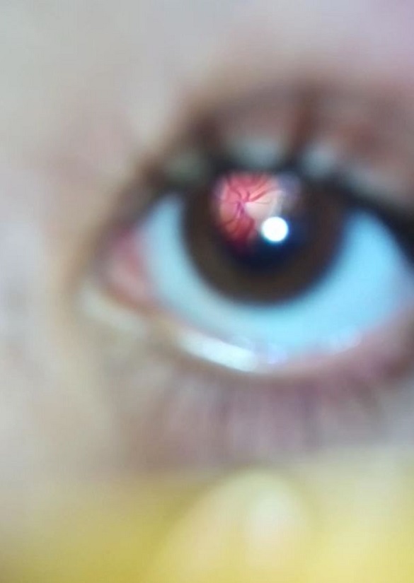 Histology Slides Database: Fundus and Retinal Photography using cell ...