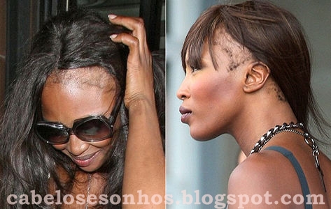 Cabelos Quebrados na Frente: Como Acontece e o que Fazer? - Cabelos E ...