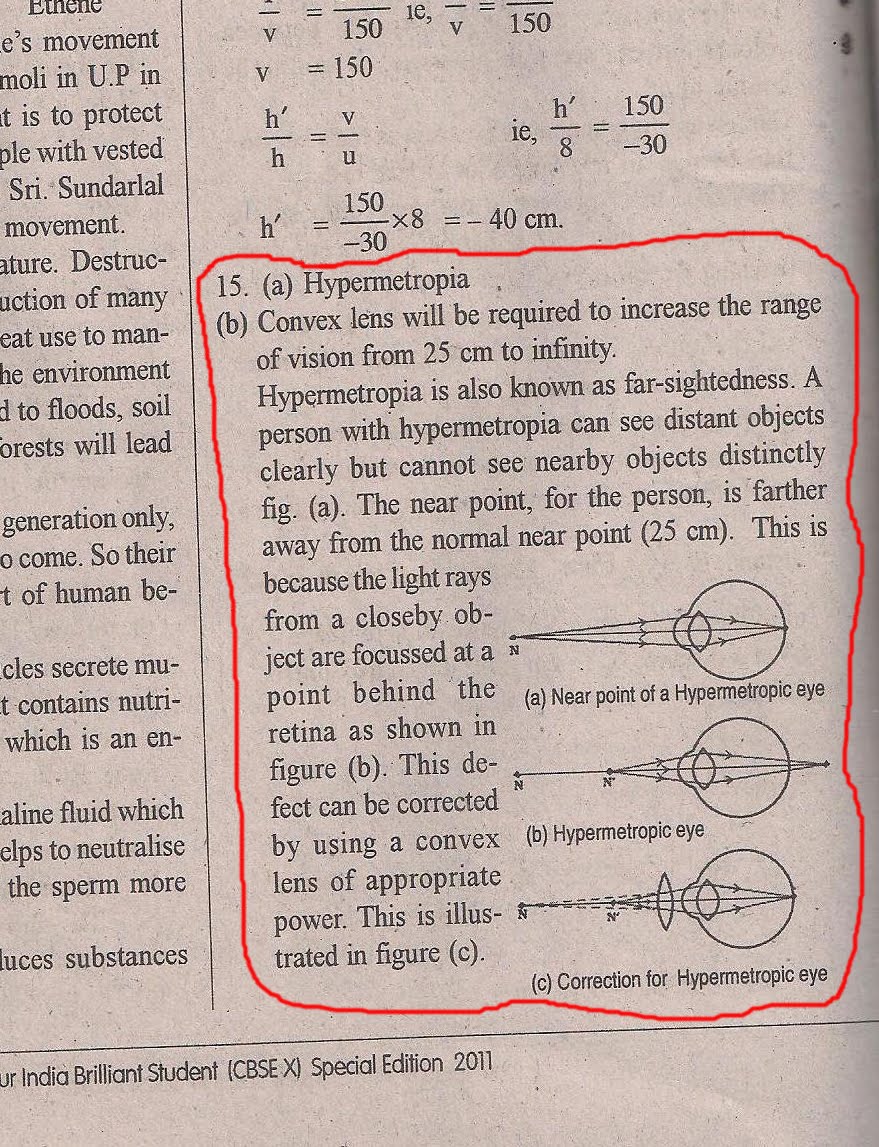 "This World Is So Small": Difference between Hypermetropia and Presbyopia