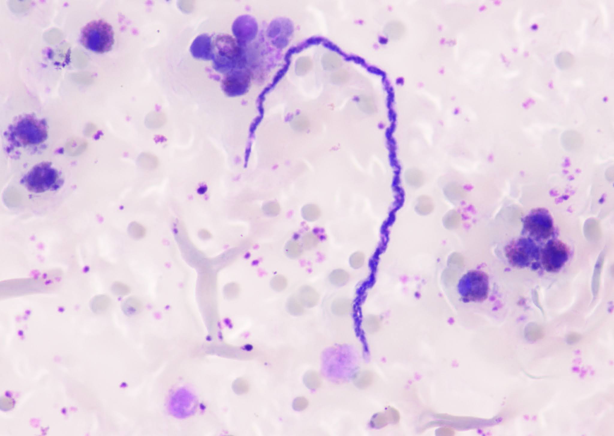 Creepy Dreadful Wonderful Parasites: Case of the Week 661