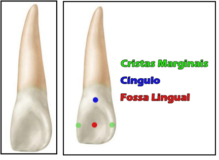 Aula de Anatomia Dental - Incisivo Lateral Superior - Dente 12 e 22