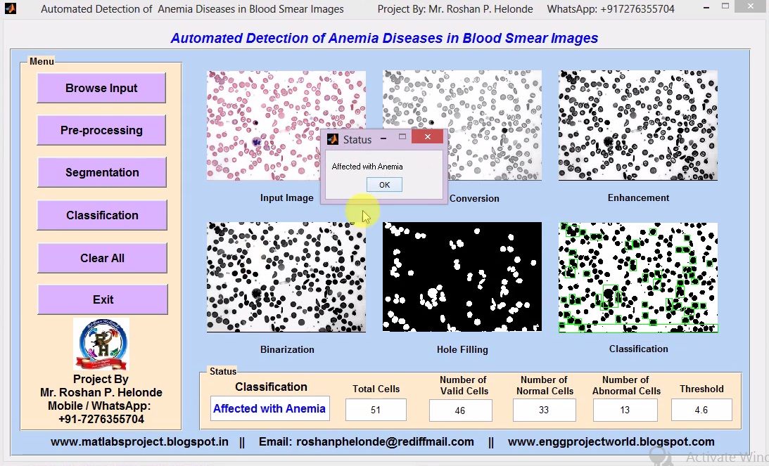 Detection of Anemia Diseases Present in Blood Cells Smear Using Image ...