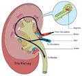 Askep CKD ( CHRONIC KIDNEY DISEASE ) - ASUHAN KEPERAWATAN