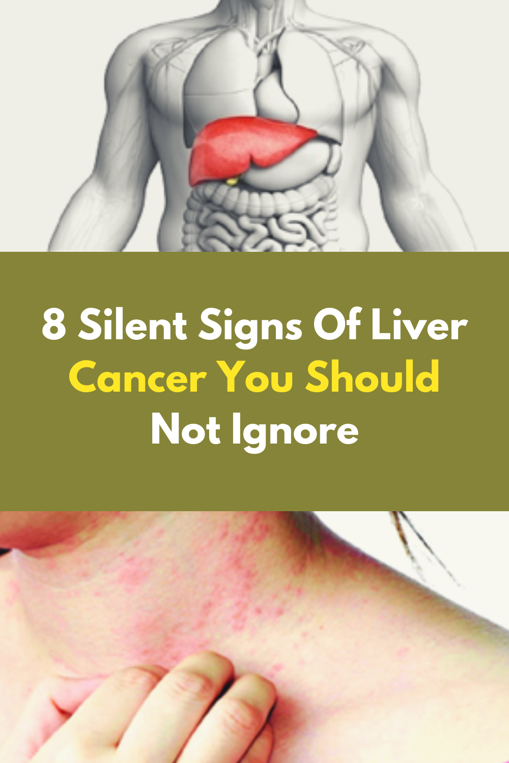 8 Silent Signs Of Liver Cancer You Should Not Ignore