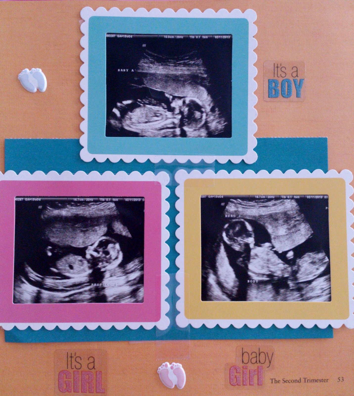 Triplets Toddler 4 Months Pregnant triplets-toddler-4-months-pregnant