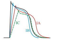 Medical MindMaps for USMLE Step 1: Antiarrhytmics Na+ Channel Blockers ...