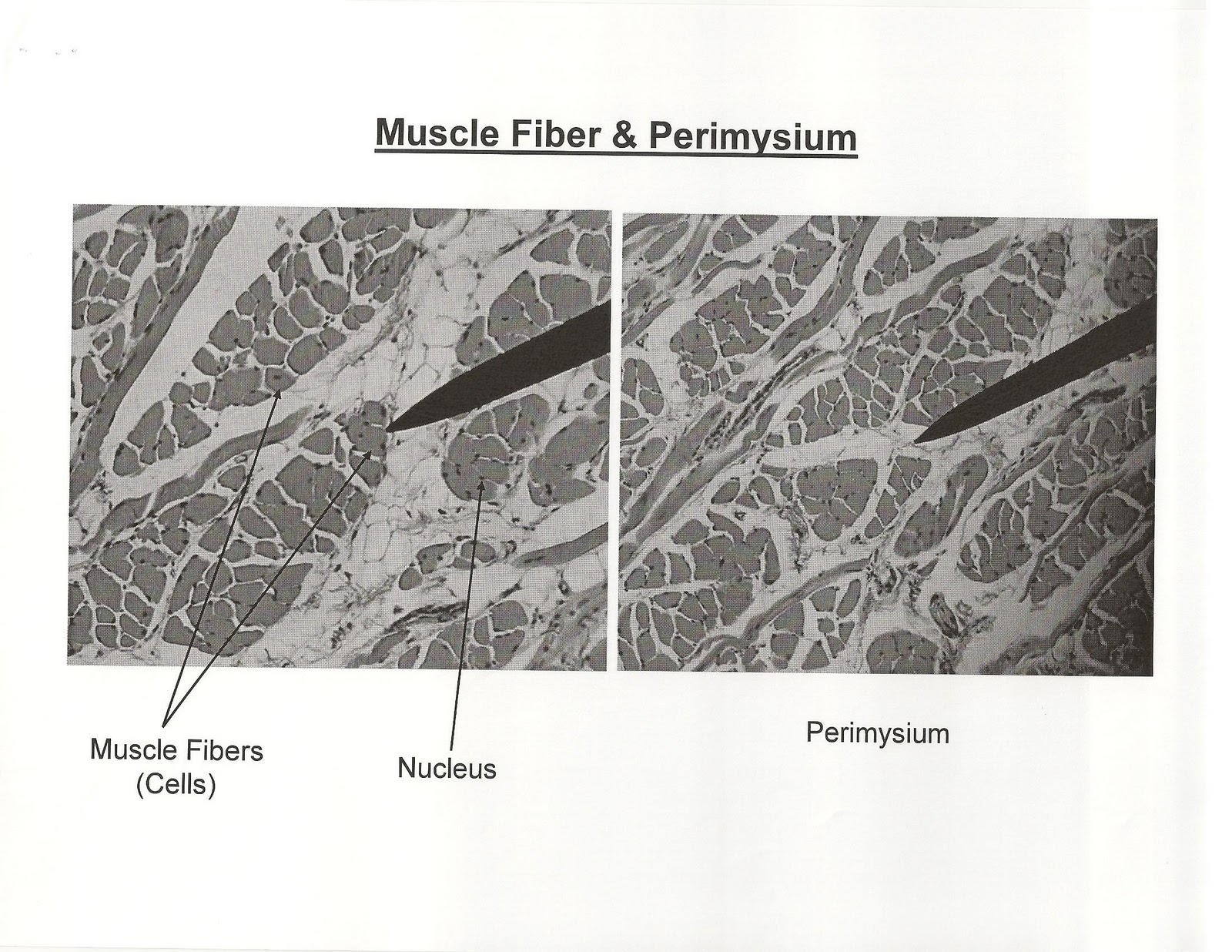 ANATOMY & PHYSIOLOGY I BIS 240: Muscle Fiber and Perimysium