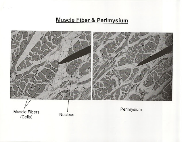 ANATOMY & PHYSIOLOGY I BIS 240: Muscle Fiber and Perimysium