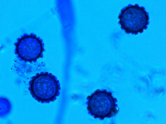 Fun With Microbiology (What's Buggin' You?): Sepedonium species