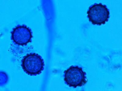 Fun With Microbiology (What's Buggin' You?): Sepedonium species