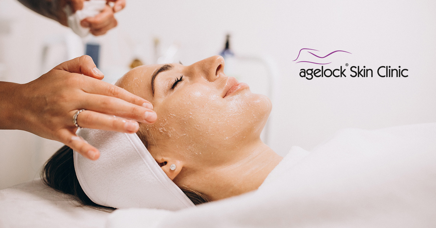 How to Get Smooth, Supple Skin by Removing Acne Scars