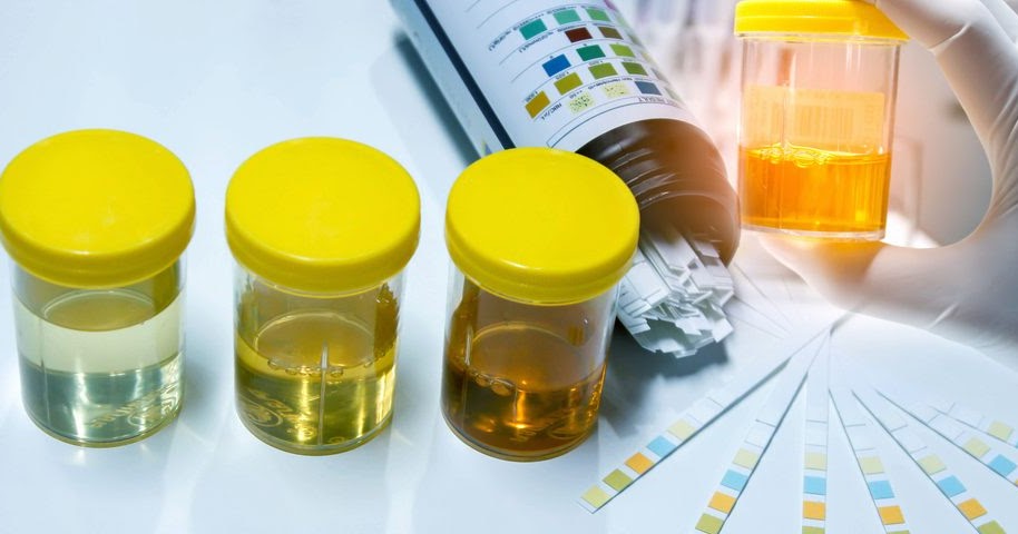 traitement de l'insuffisance rénale: Comment le patient atteint de ...