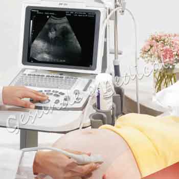 Harga Alat USG MINDRAY 2 Dimensi | Alat Ultrasonografi 2D (Dua Dimensi ...