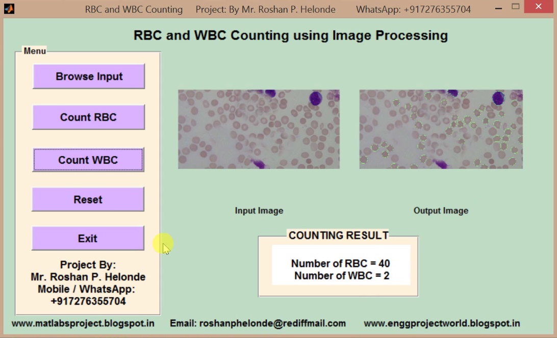 RBC and WBC Detection and Counting using Image Processing Matlab project code ~ MATLAB PROJECTS