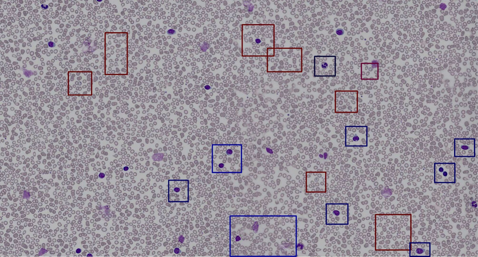 A Dull Day At Work...?: 18 January 2017 (Wednesday) - NEQAS Digital ...