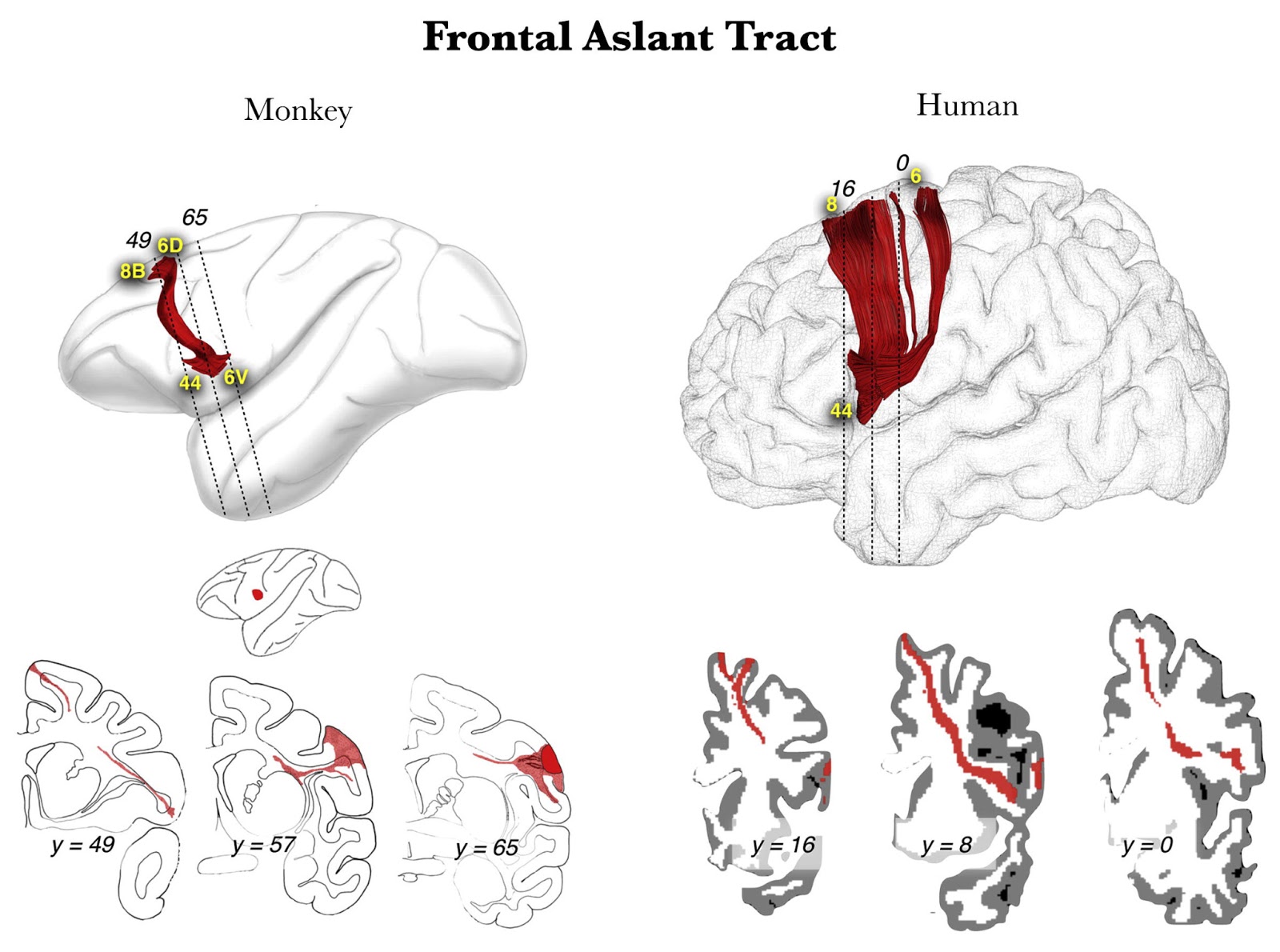 The Neurocomplimenter: A New Slant on Frontal Connectivity: the Frontal ...