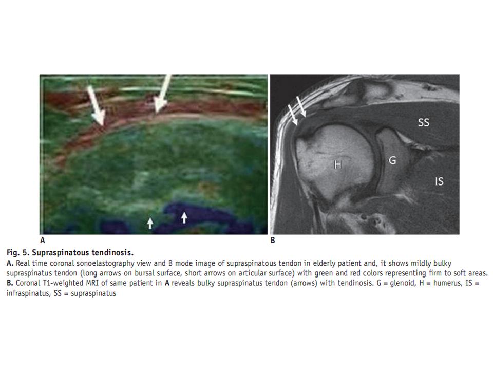 BÀI SOẠN VỀ SIÊU ÂM CHẨN ĐOÁN: MSK Applications of Real-time ...