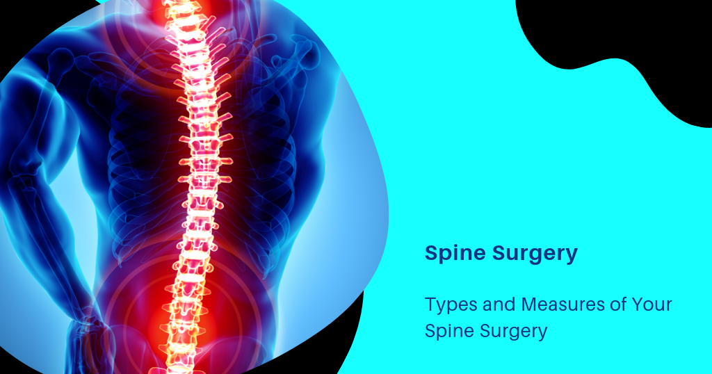 Types and Measures of Your Spine Surgery