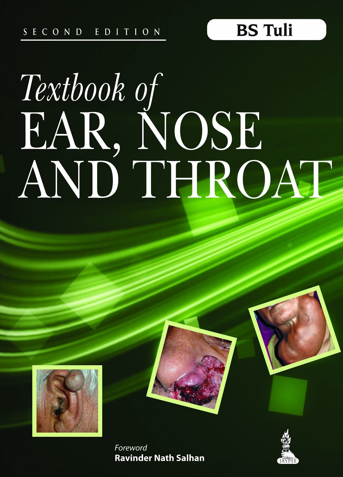 Textbook of Ear, Nose and Throat 2nd Edition - Medical Book For Free ...