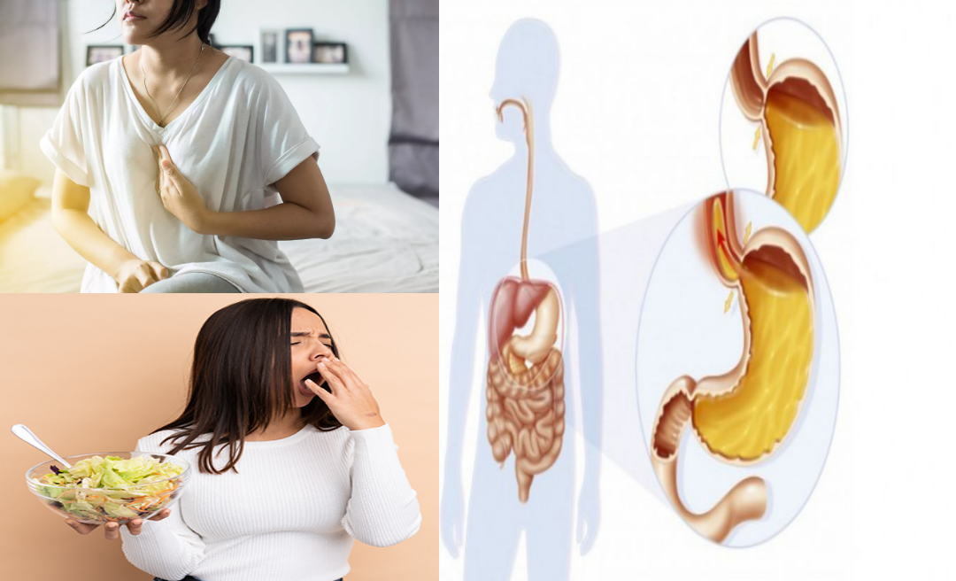 4 aliments à consommer pour soulager le reflux gastro-œsophagien