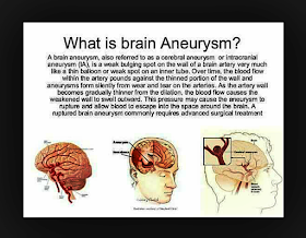 Travel, Photographs and Lifestyle: RUPTURED BRAIN ANEURYSM: Living with ...