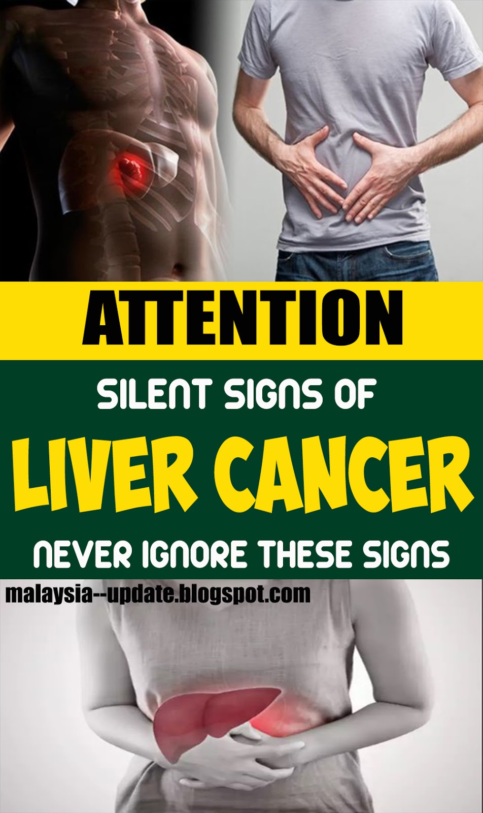Quiet Signs Of Liver Cancer You Should Not Ignore In Your Life ...