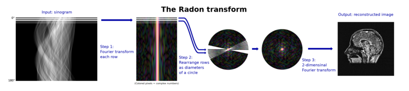 조금은 느리게 살자: 라돈 변환(Radon Transform)