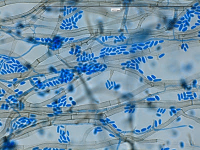 Fun With Microbiology (What's Buggin' You?): Pleruostomophora richardsiae