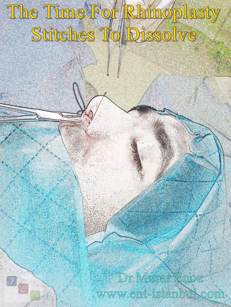 When Will All Sutures Completely Dissolve After Rhinoplasty?