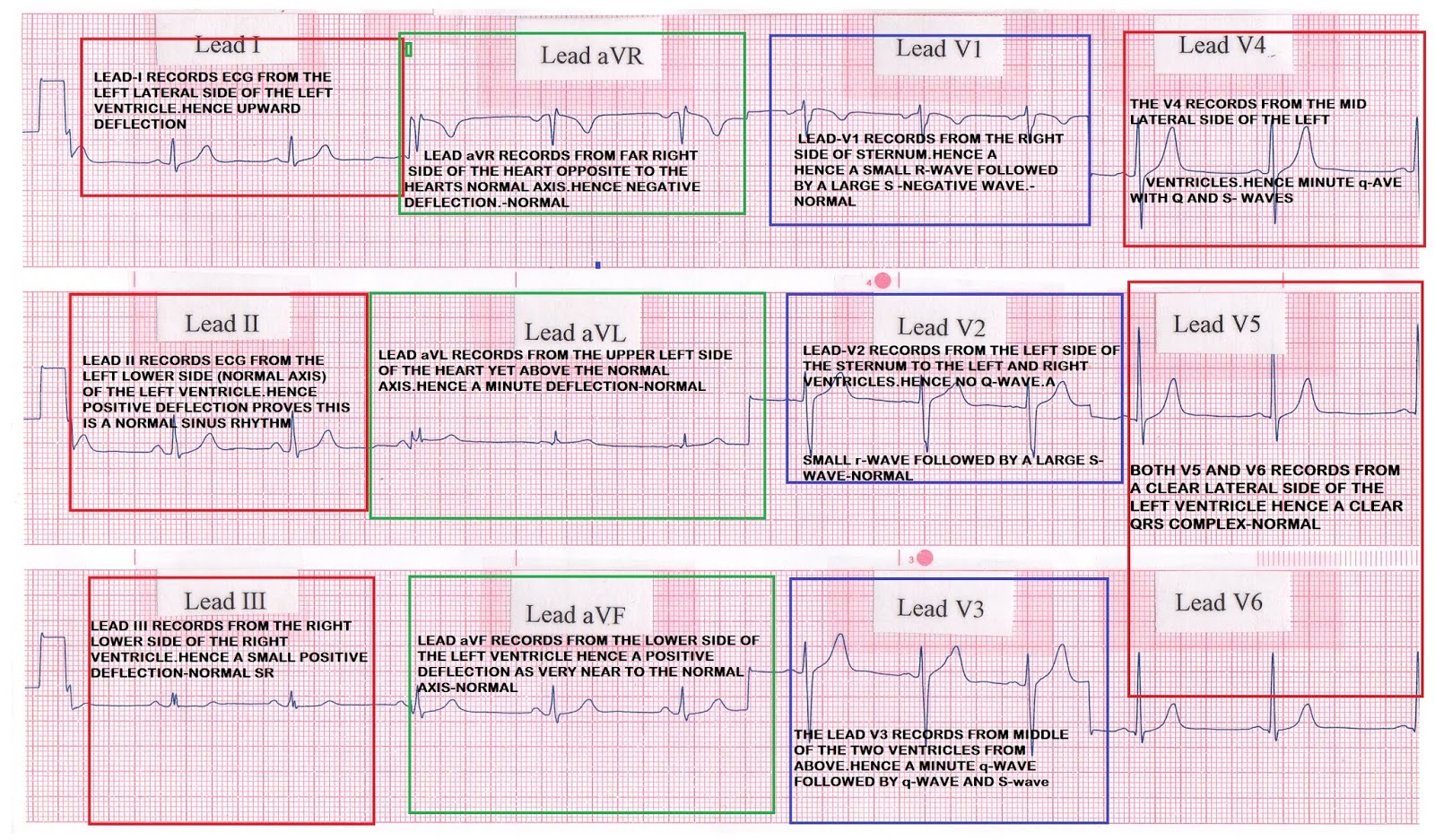 MAS PHARMACY REVIEW-HEALTH TIMES: SUMMARY-ECG EDUCATION-F-SAMPLE ECGS ...