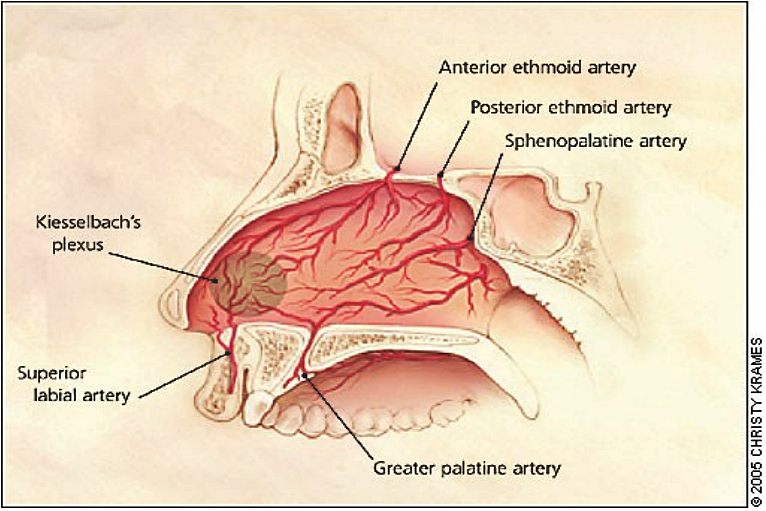 lemon tea and cookies: REFERAT ABSES SEPTUM NASI